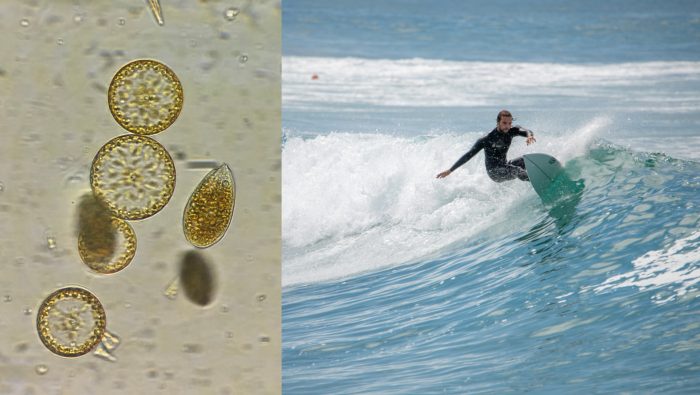 Obľúbenú európsku destináciu zamorili nebezpečné riasy